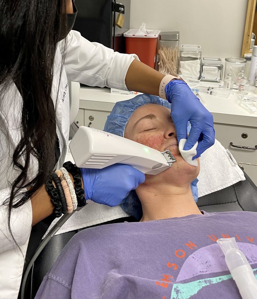 Profound RF Archives Blog - The Skin Center by CPS